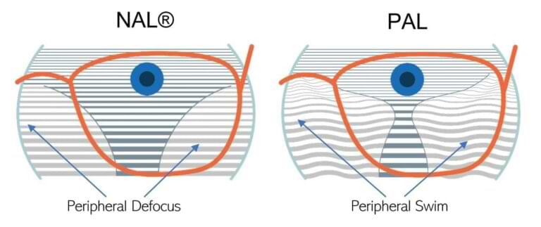 OmniLux® NAL® Lense | BestNewGlasses.com